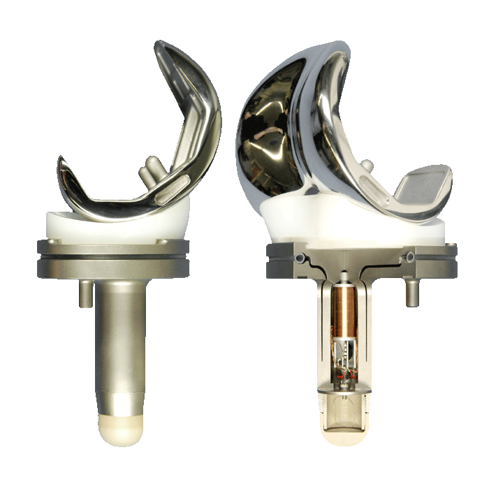 Physiotherapy Still Important After Total Knee Replacement