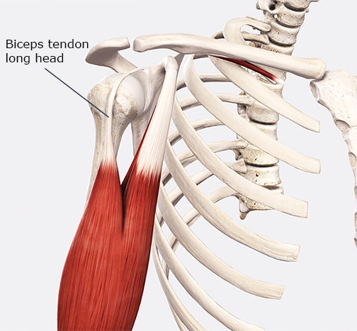 Biceps Tendon and Shoulder Pain: A Gym-Goer's Guide